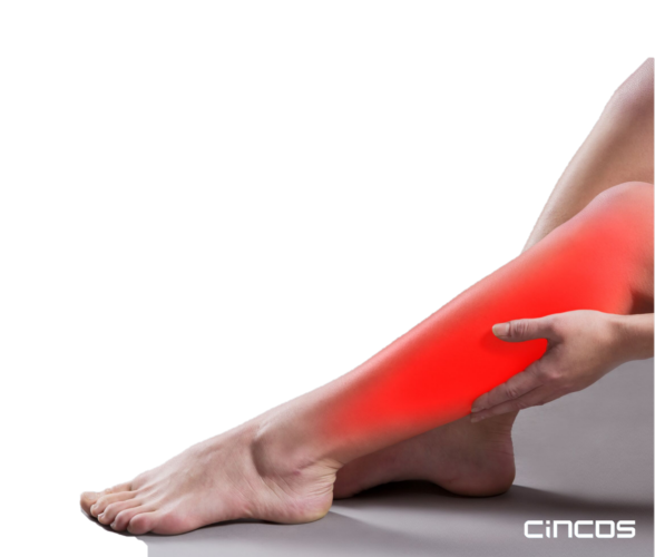 Esclerosis de varices, qué tipos hay , cual utilizar según el caso | Cincos